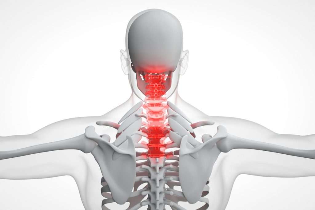 Misalignment Of Cervical Spine - Symptoms and Treatment Options